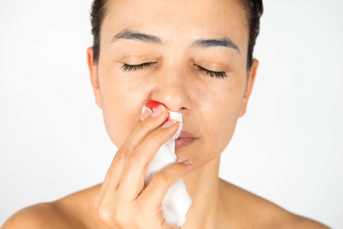 The Great Myth about Nosebleeds - First Aid Accident and Emergency